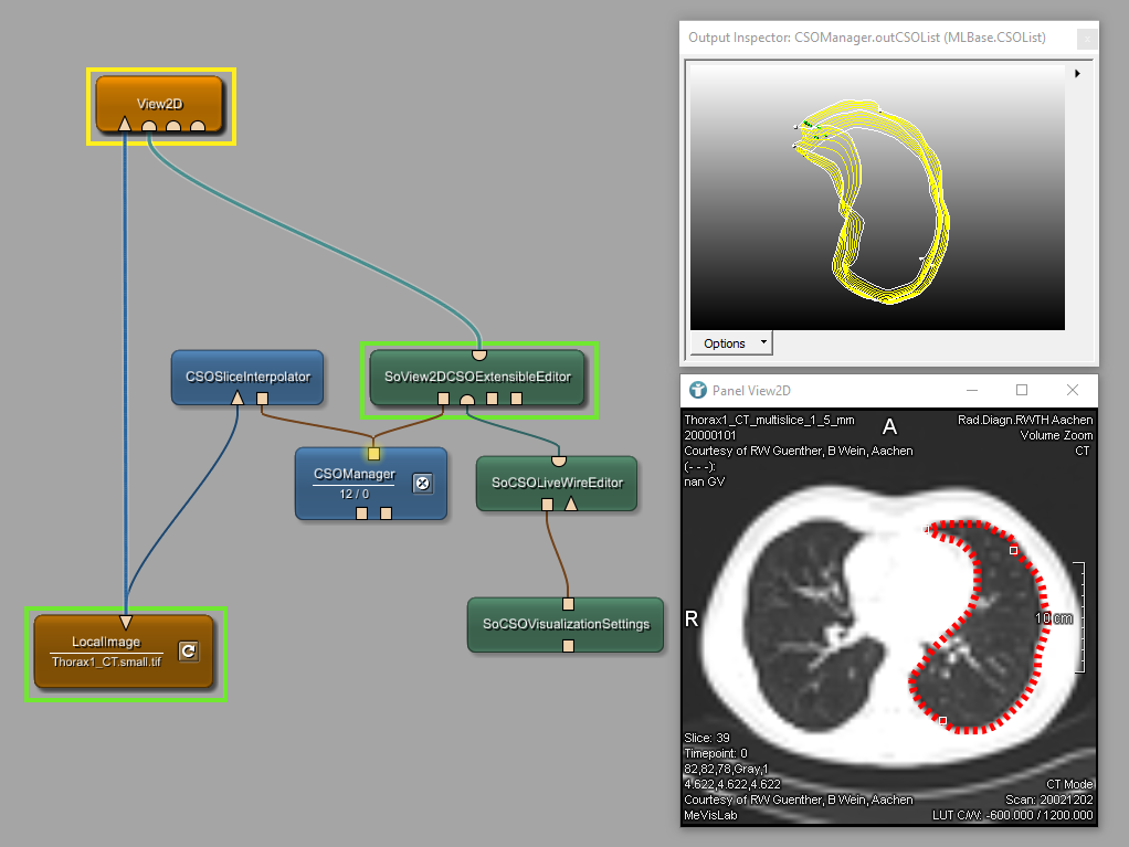 2D And 3D Visualization Of Contours