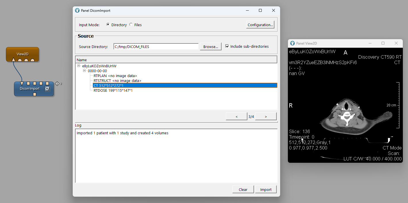 Example 6: DICOM RT Visualization in MeVisLab – RTSTRUCT and RTDOSE Workflow